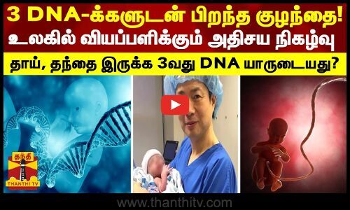 3 DNA-க்களுடன் பிறந்த குழந்தை! உலகில் வியப்பளிக்கும் அதிசய நிகழ்வு ...